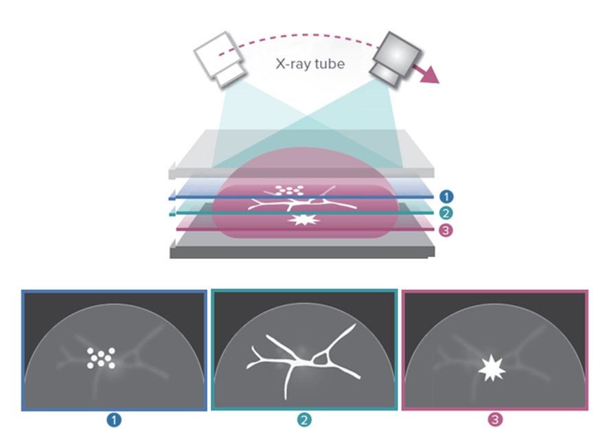¿Qué es la tomosíntesis y cual es su función?