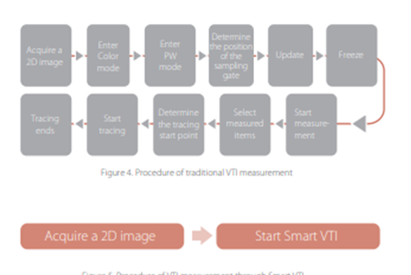 ¿Qué es la herramienta SMART VTI en DXI?